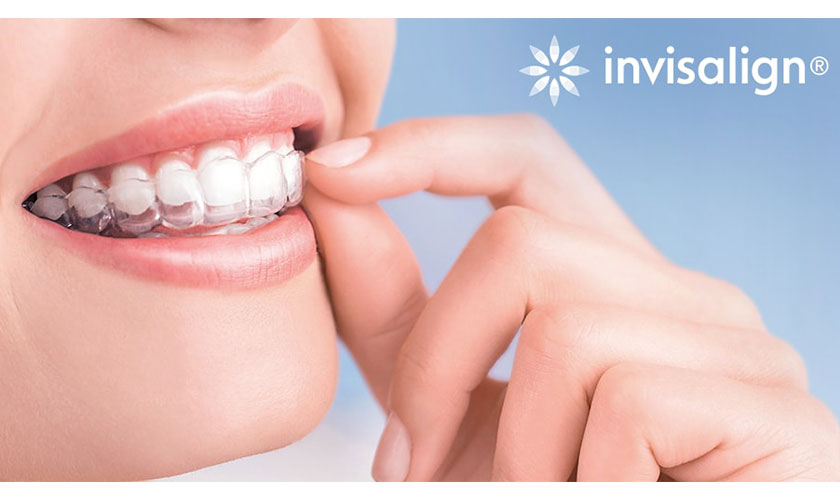 Unnoticeable Braces Invisible Braces Alpha Dental